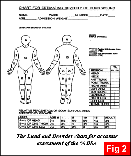 Adult burns | Right Decisions