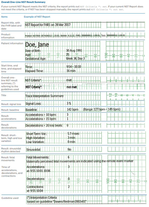 Computerised CTG SOP | Right Decisions
